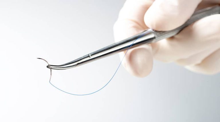 Facial Lacerations - Foley & Le Oral Surgery | Oral and Maxillofacial ...